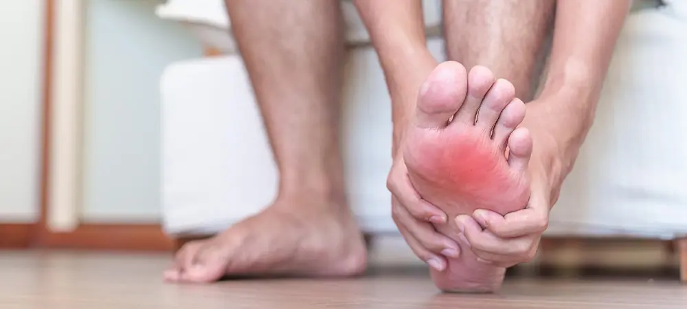 Plantar Fibroma Pictures Treatment Surgery Symptoms Plantar Fibroma